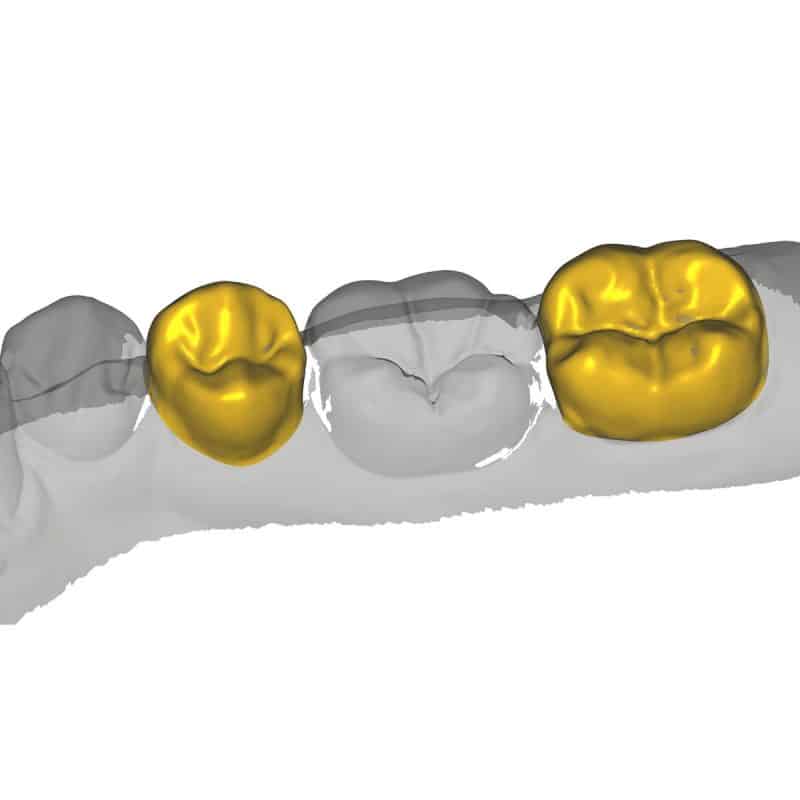 EXOCAD Dynamic Price Comparison - Bristol CadCam